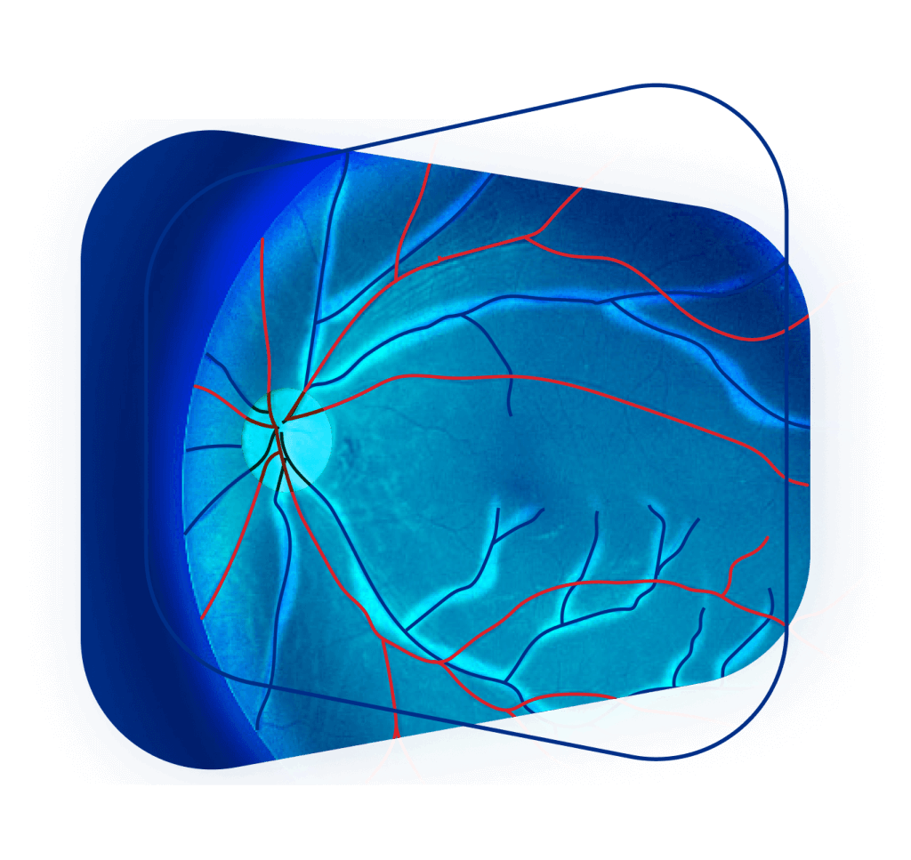 About Optain Health: AI-Enabled Retinal Imaging | Optain Health