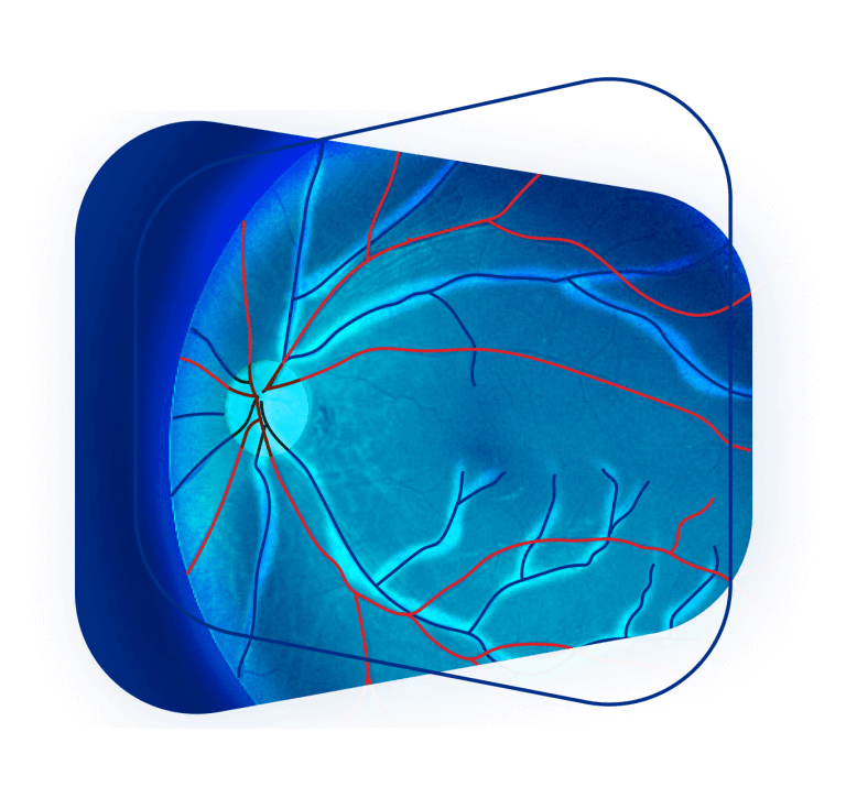 About Optain Health: AI-Enabled Retinal Imaging | Optain Health