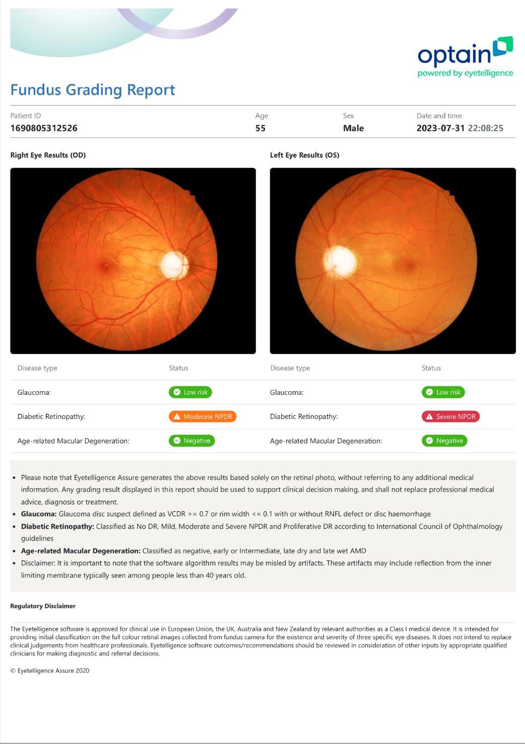 Eyetelligence Assure: AI Retinal Screening Tool | Optain Health