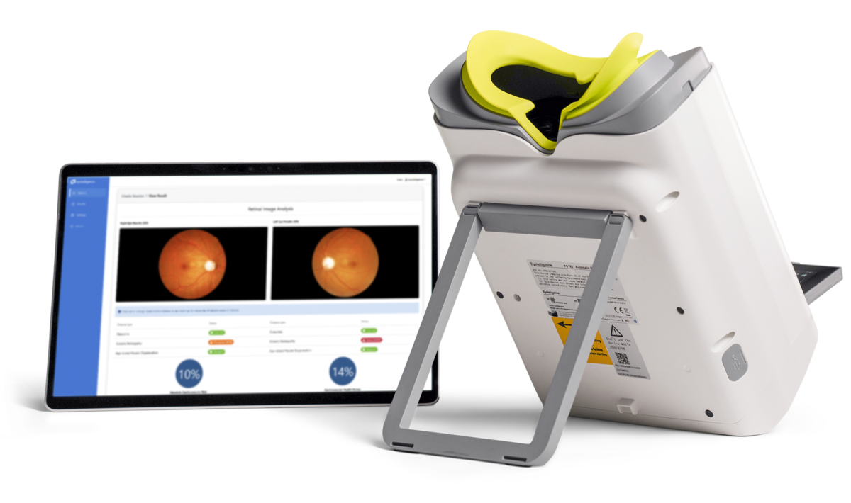 AI Retinal Imaging for Early Disease Detection | Optain Health